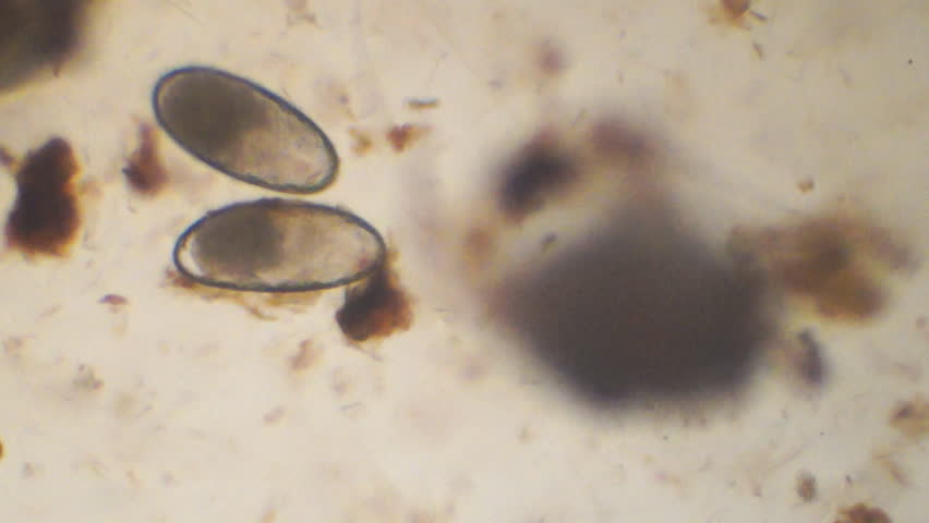 Veterinary Medicine Ear Swab Of A Cats Ear Revealing Heavy Ear Mite Otodectes Cynotis