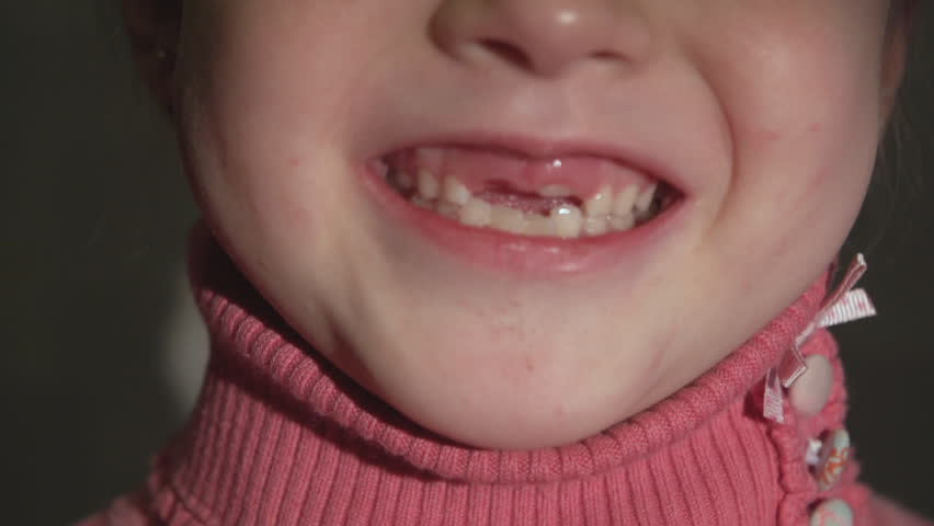 Stock Footage Smiling Girl Who Has No Front Teeth Stock Footage Video ...