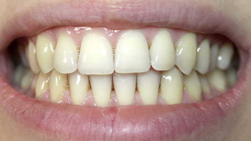 Super Close-up View Of Woman Showing Teeth. Dentistry Concept Full HD ...